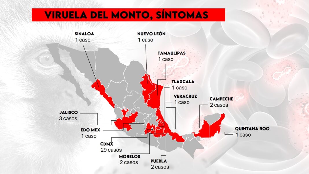 Principales síntomas de la viruela del mono en la península de Yucatán
